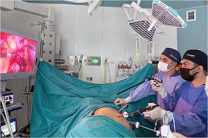 Kidney Cancer Surgery Turkey - Assoc. Prof. Dr. Arif Demirbaş